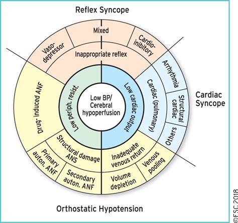 Transient Loss Of Consciousness Syncope Vs Epileptic Seizure — Gpraj