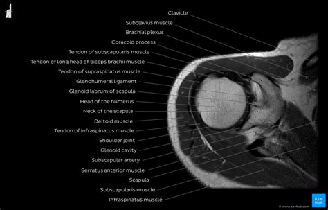 Axial Mri Of Upper Limb Coracoid Process Level Section 5 12