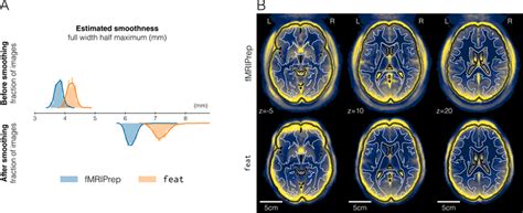 Fmriprep A Robust Preprocessing Pipeline For Functional Mri Pubmed Fmriprep A Robust Preprocessing Pipeline For Functional Mri Pubmed