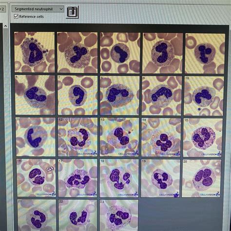 Found Out You Can Set Your Own “reference” Cells In Cellavisionoops