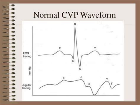 Ppt Anesthesia Monitoring Powerpoint Presentation Free Download Id 4635549