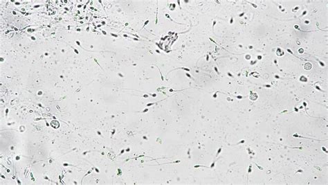 Spermogram Bilder Bläddra Bland 306 Stockfoton Vektorer Och Videor