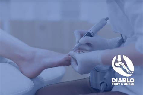 Sprained Ankle Self Care The Dos And Donts Podiatrist In Walnut Creek