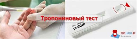 Тропониновый тест - что это, для чего, как проводится, что показывает