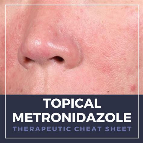 Flagyl Allergic Reactions Flagyl 200 Mg Suspension 60 Ml Uses Side