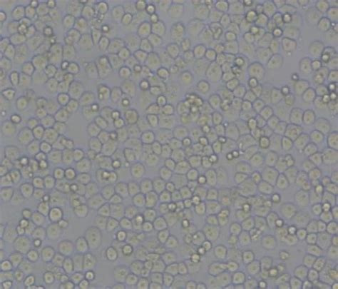 Iphase汇智和源原代肝细胞助力药物酶诱导研究 知乎