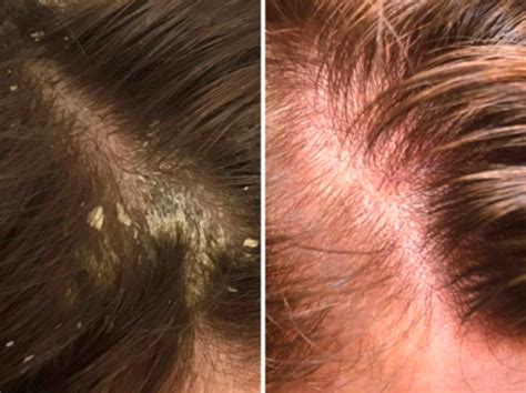 26 Products That Have Before And After Photos We Swear We Didnt
