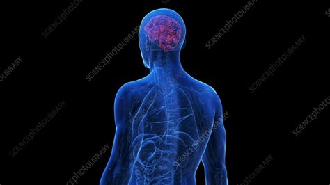 Animation Of An Infected Brain Stock Video Clip K012 0099 Science Photo Library