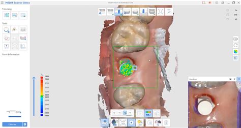 Welcome To Digital Dentistry Page 7 Of 48 Cad
