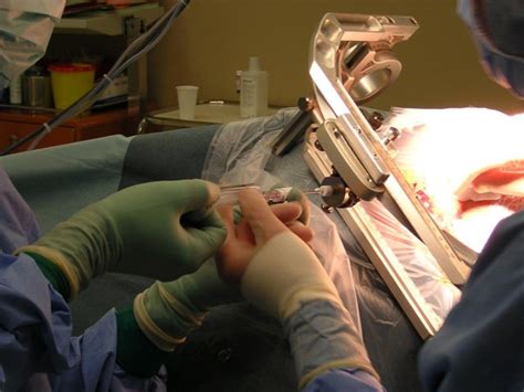 Biopsy Types Purpose Risks And Other Information Healthtian