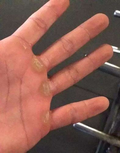 Callus And Sebum单词卡 Quizlet