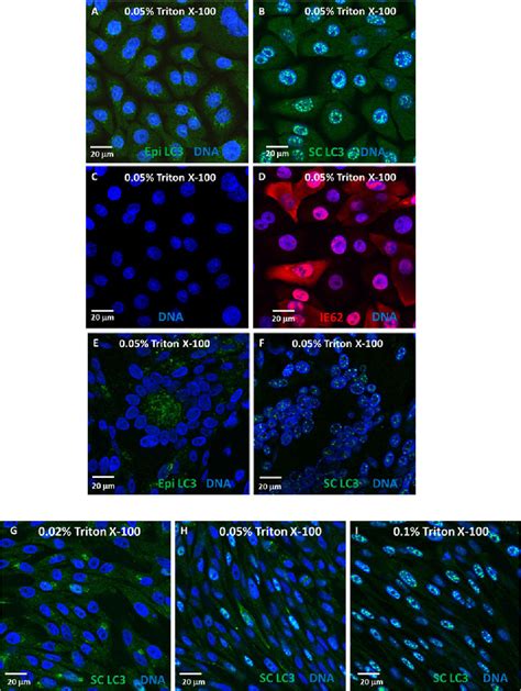 Figure 1 From Nuclear Lc3 Positive Puncta In Stressed Cells Do Not Represent Autophagosomes