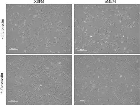 Effect Of Expansion Media And Fibronectin Coating On Growth And Chondrogenic Differentiation Of