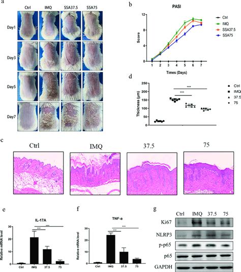 Effects Of Ssa On Imq Induced Mice Psoriatic Mouse Model Was Induced