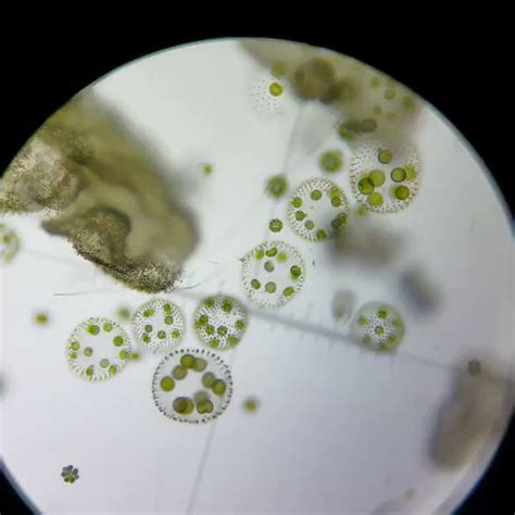 Volvox Under Microscope