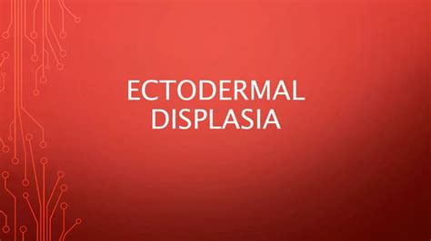 Ectodermal Dysplasia Pptx