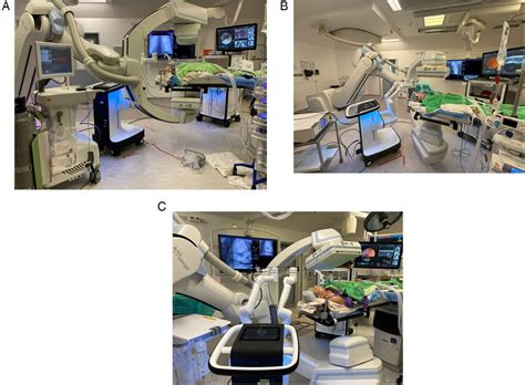 Frontiers Robotic Assisted Bronchoscopy—advancing Lung Cancer Management