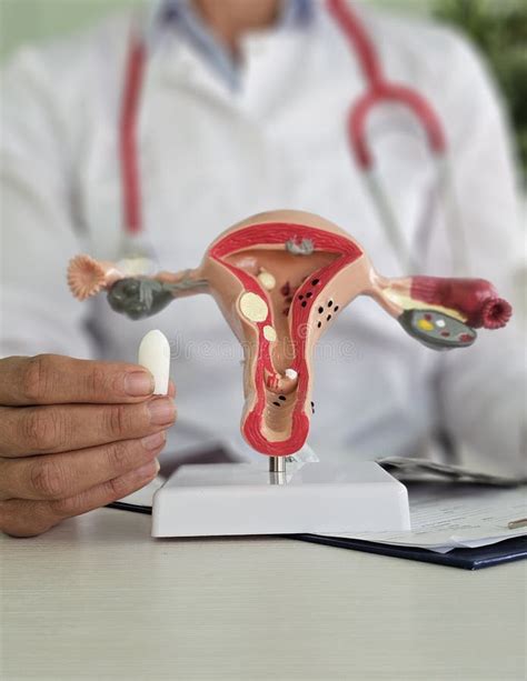 Model Of Female Reproductive System And Suppository Medical Tablet