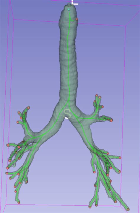 how to use vmtk split the vessel tree s branch development 3d