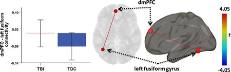 Roi‐to‐roi Functional Connectivity Analysis In The Exploration Sample