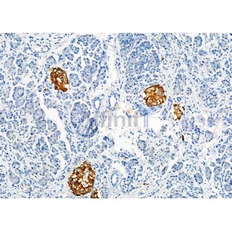 Fgf10 Antibody Affinity Biosciences Ltd亲科生物官网