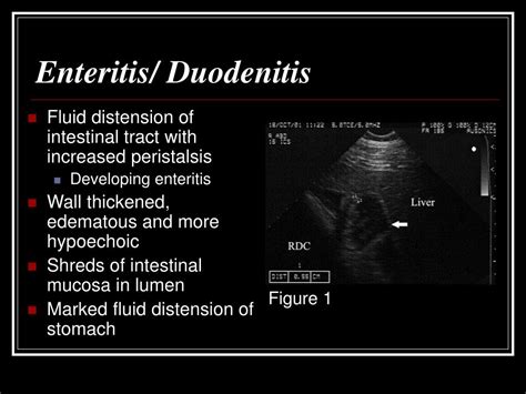 Ppt Equine Colic Ultrasonographic And Radiographic Diagnosis