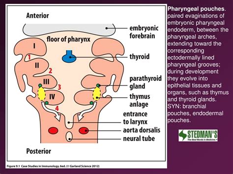 Ppt Immunodeficiencies Digeorge Syndrome And Thymic Defects Powerpoint
