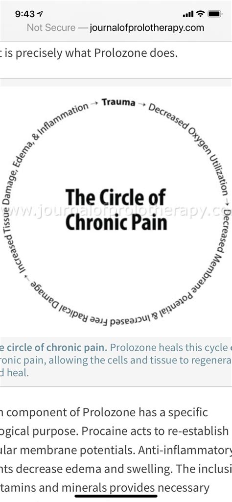 Steven Licata D O On Linkedin In Addition To Prolotherapy Which I Have Been Doing For 20 Years