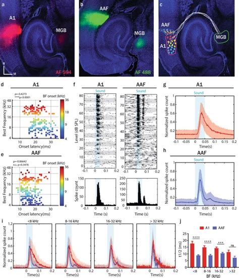 Magdalena Sołyga On Linkedin Distinct Processing Of Tone Offset In Two