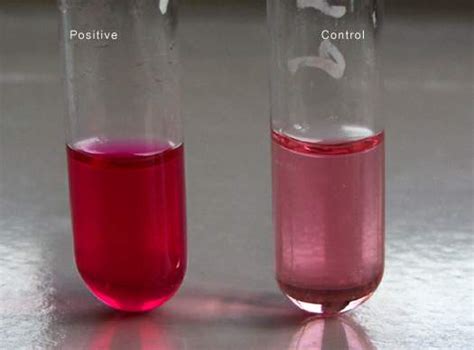 Inulin Fermentation Test For Penumococci Differentiation Medical