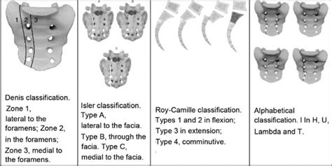Sacral Fracture Classification
