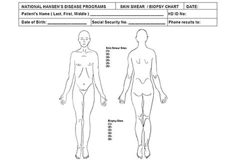 Leprosy Slideshow