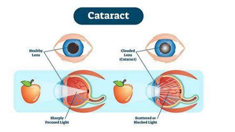 Human Eye And Colourful World Class 10 Pptx