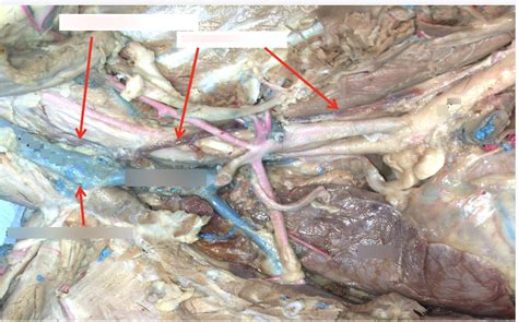 Diagram Of Thoracic Duct Quizlet