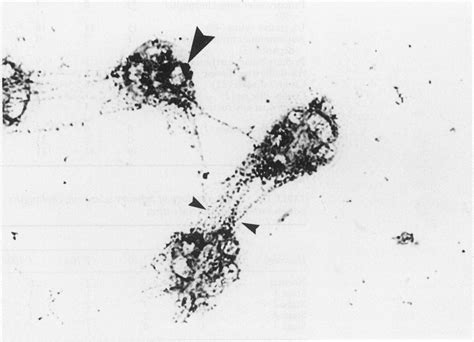 Type 1 Pattern Of Staining Note The Granular Cytoplasm With Download Scientific Diagram
