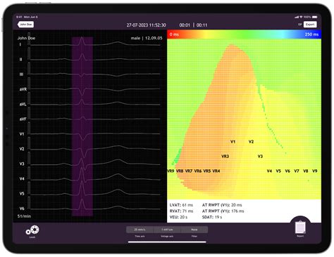 Cardiosecur Pro Pace Cardiosecur