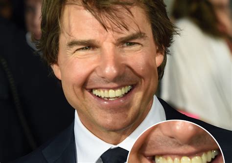 Tom Cruise Front Teeth