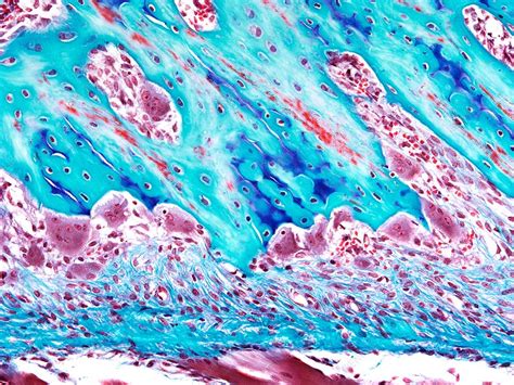 Osteoclasts Light Micrograph Stock Image C024 8096 Science Photo Library