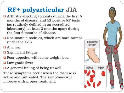 Juvenile Idiopathic Arthritis Jia Pptx