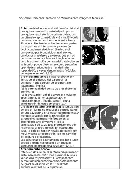 Glosario De Términos De Imágenes Torácicas Pdf