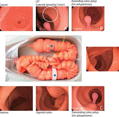 Koken Colonoscopy Lower Gi Endoscopy Simulator Type Ii Adamrouilly