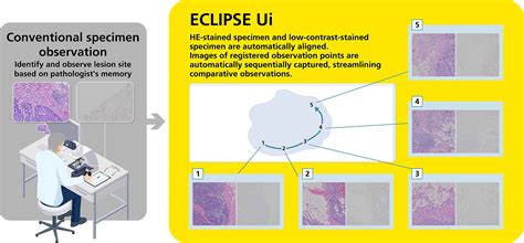 Nikon Launches The Eclipse Ui Ver 13 Digital Imaging Microscope For Medical Use Notícias