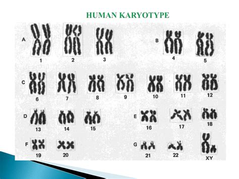 Autosomes Allosomes And Sex Ratio In Human Population Pdf