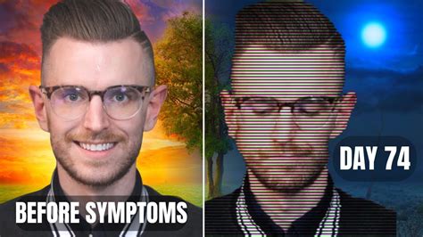 Derealization Made Me Forget What Normal Feels Like 4 Tips Youtube