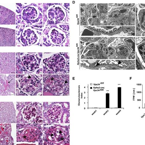 Podocyte Speci Fi C Vps34 De Fi Ciency Causes Rapid Podocyte Download Scientific Diagram