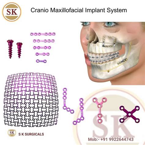 Cmf Implants Craniomaxillofacial Plate At ₹ 395piece Maxillofacial