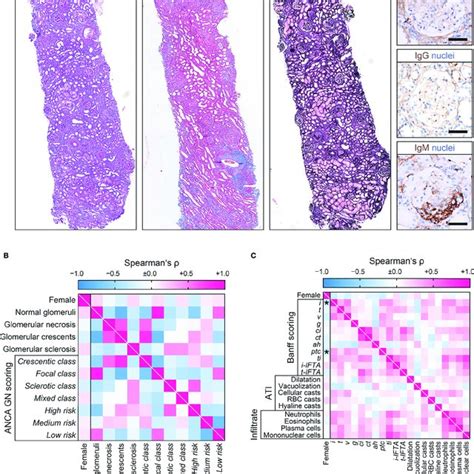 Sex Differences Among Histopathological Findings At Disease