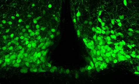 Exploring Brain Plasticity With Single Cell Precision