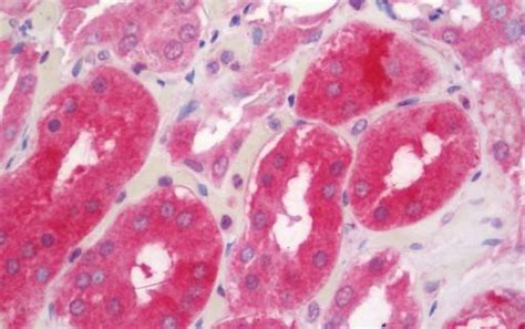 Ikbkg Nemo Ikk Gamma Antibody Aa51 100 Rabbit Polyclonal