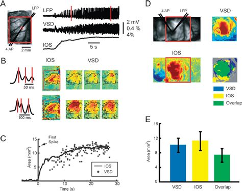 Figure 8 From Dynamic Neurovascular Coupling And Uncoupling During